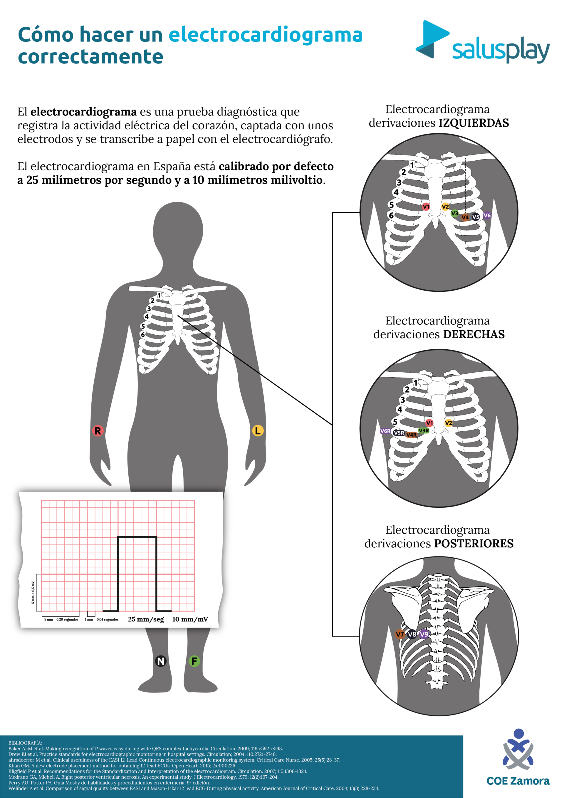 Infografía basada en evidencias – Cómo hacer un electrocardiograma correctamente - COLEGIO DE ...