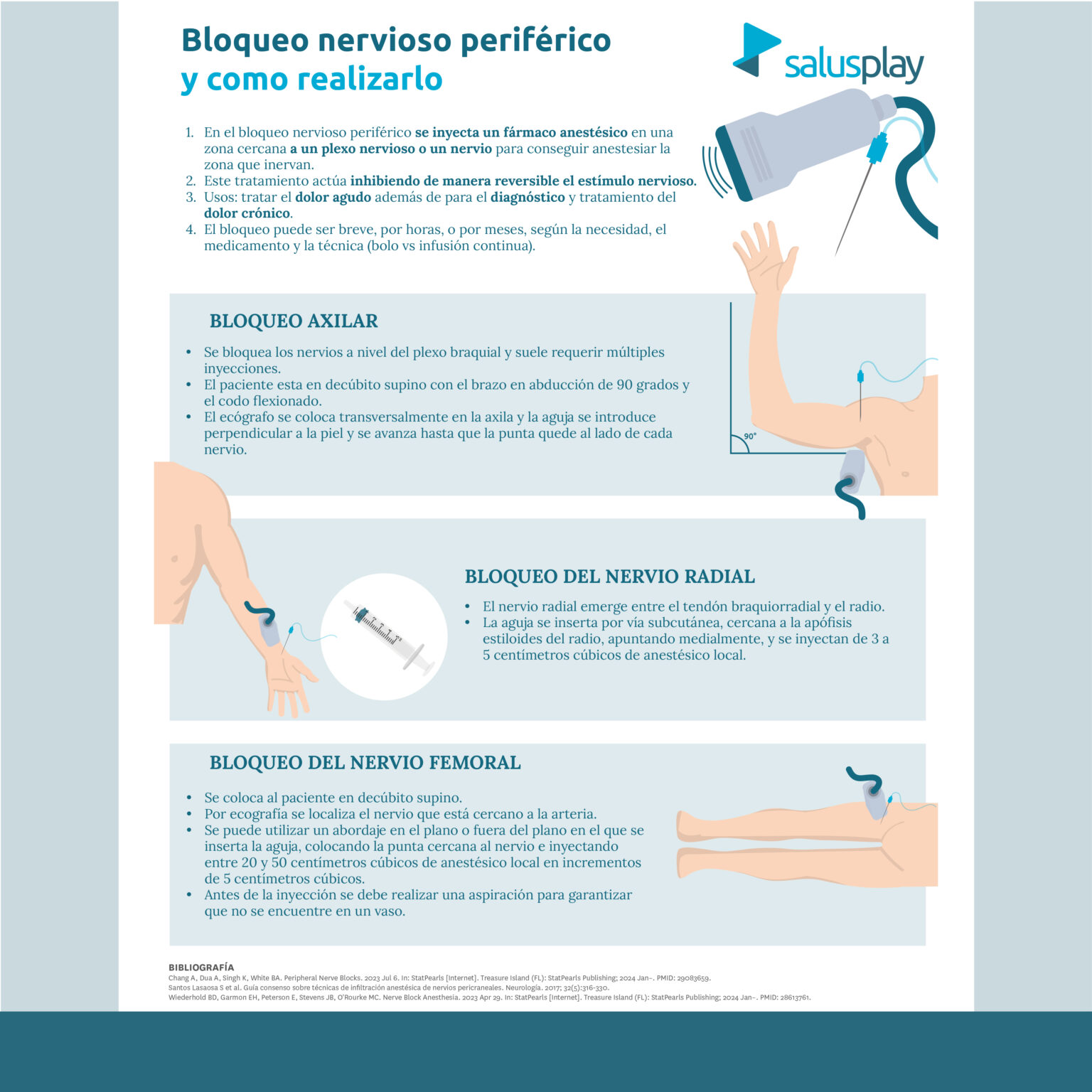 Infografía basada en evidencias – Bloqueo nervioso periférico y cómo ...