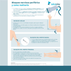 Infografía basada en evidencias – Bloqueo nervioso periférico y cómo ...
